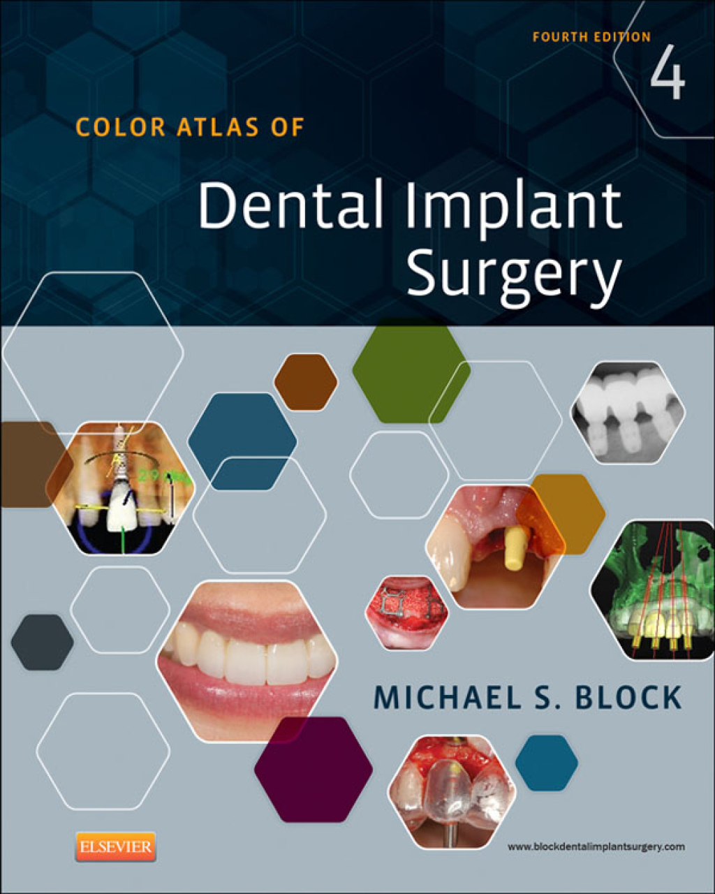 Color Atlas of Dental Implant Surgery 4th Edition â€“ PDF/EPUB Version ...