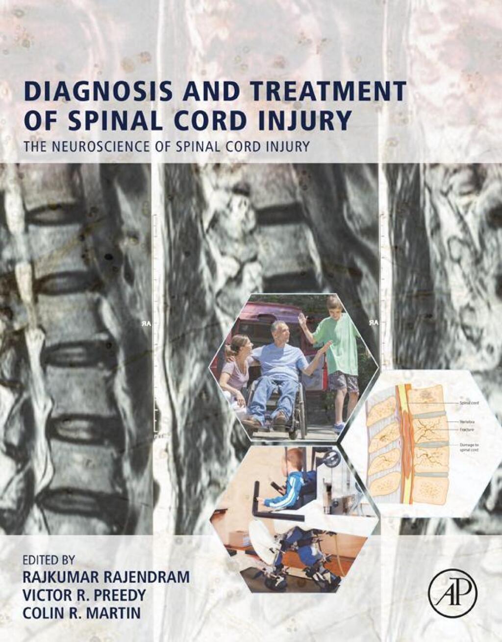 Diagnosis and Treatment of Spinal Cord Injury â€“ PDF/EPUB Version ...