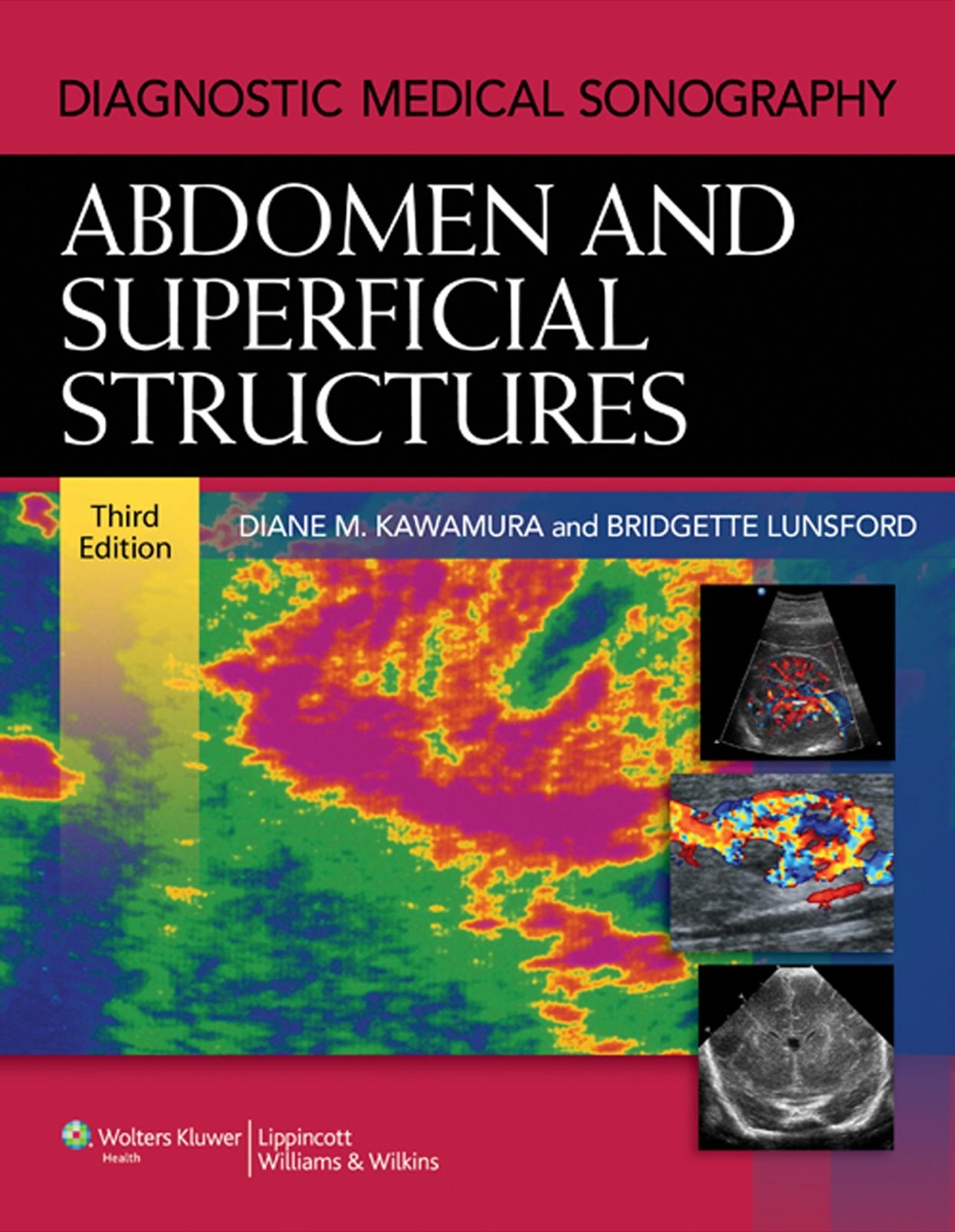 Diagnostic Medical Sonography: ABDOMEN AND SUPERFICIAL STRUCTURES 3rd ...