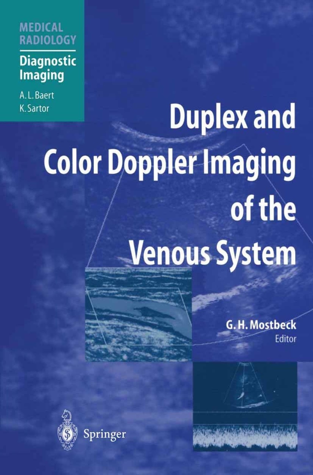 Duplex and Color Doppler Imaging of the Venous System â€“ PDF/EPUB ...