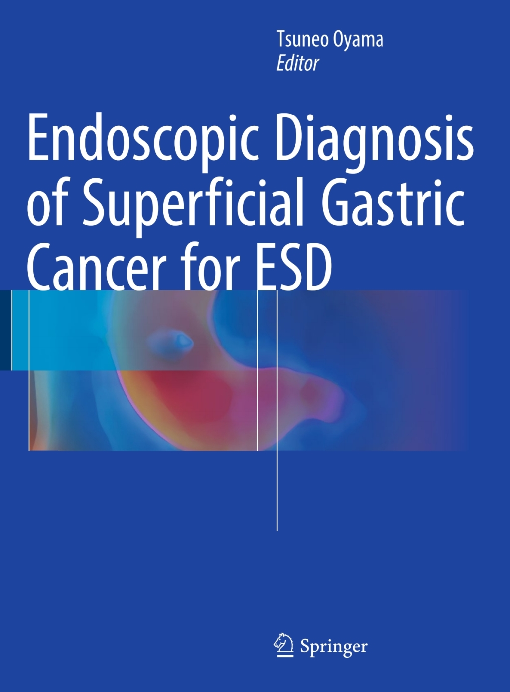 Endoscopic Diagnosis of Superficial Gastric Cancer for ESD Endoscopic ...