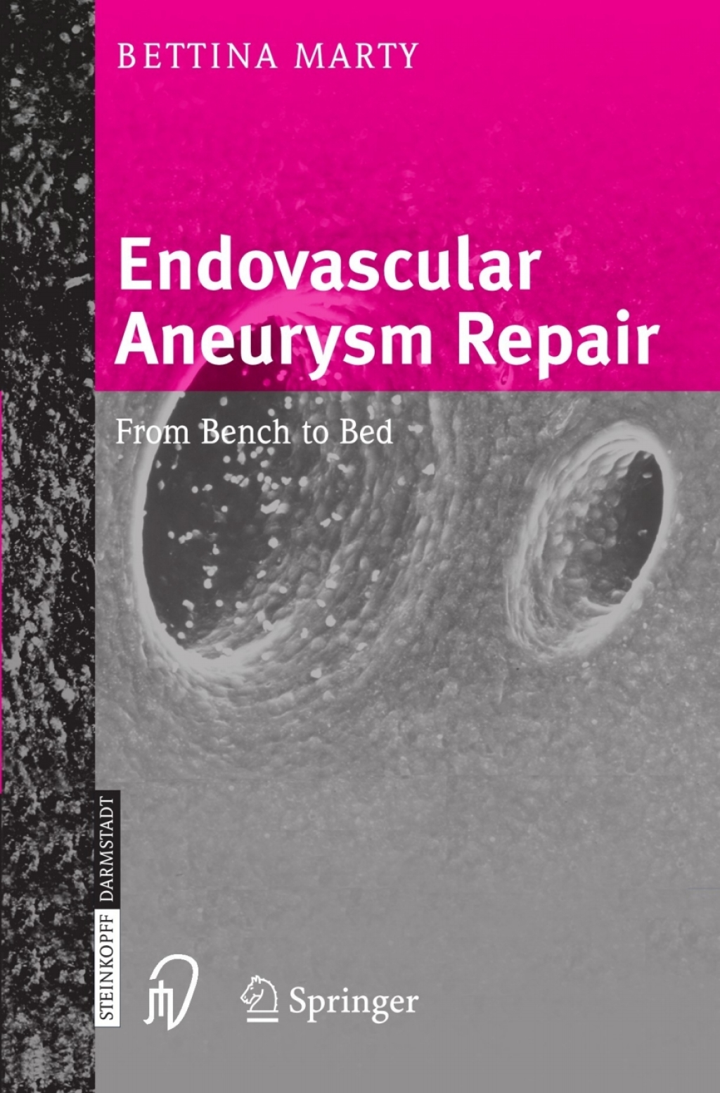 Endovascular Aneurysm Repair From Bench to Bed â€“ PDF/EPUB Version ...