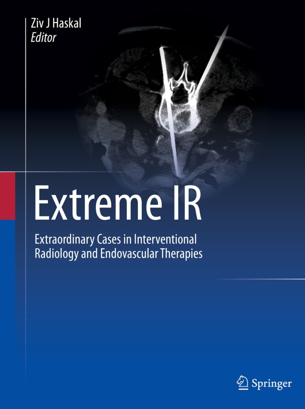 Extreme IR Extraordinary Cases in Interventional Radiology and ...