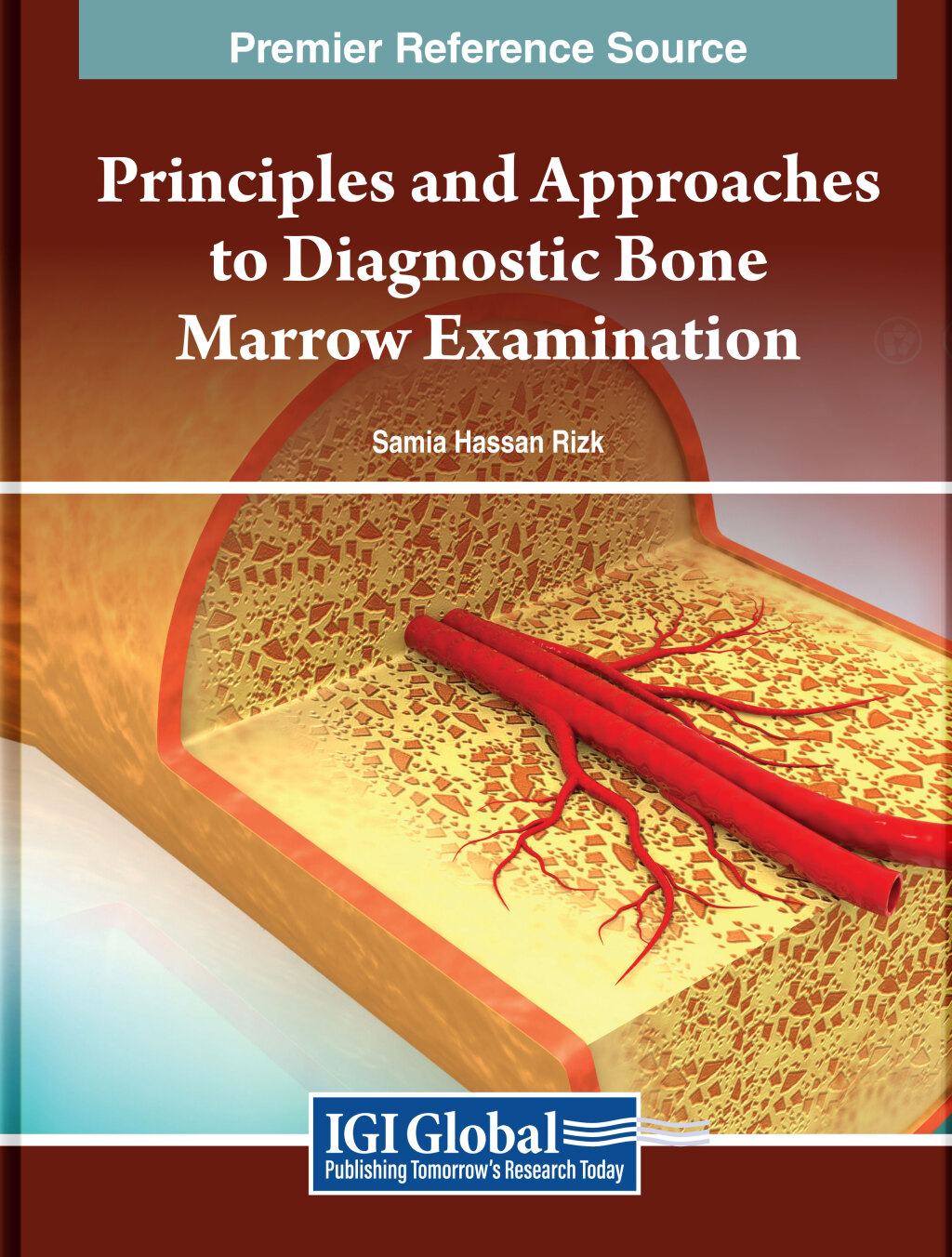 Principles and Approaches to Diagnostic Bone Marrow Examination â€“ PDF ...